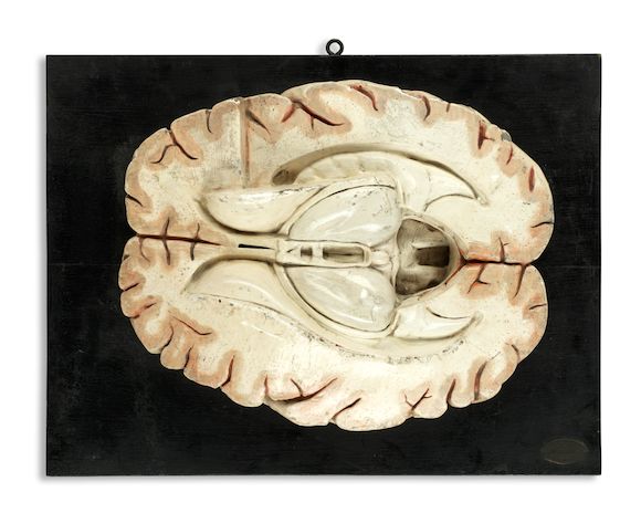 Bonhams : Three painted plaster models of a sectioned human brain ...